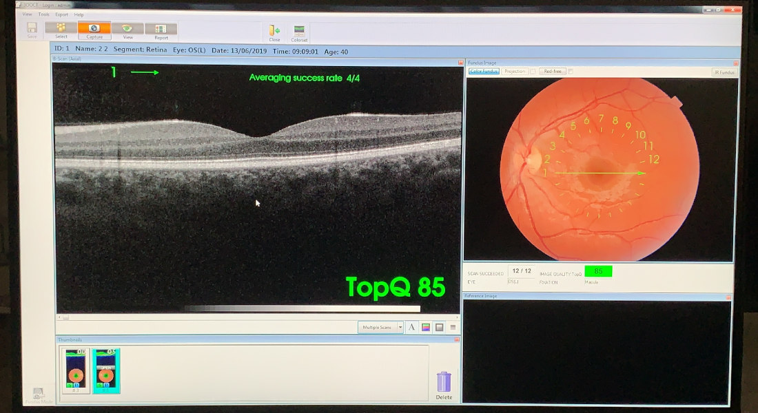 3D OCT 1 Maestro Topcon - Vendita e Assistenza OCT OMEGA ELECTRA